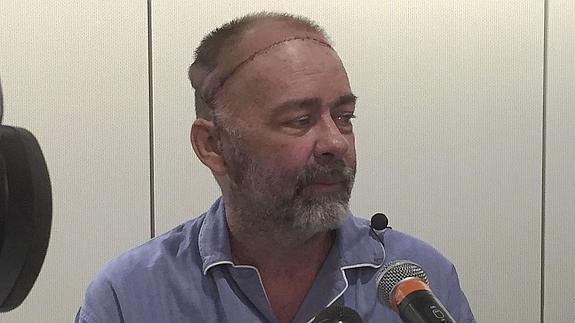 Médicos estadounidenses realizan el primer trasplante de cráneo y cuero ...